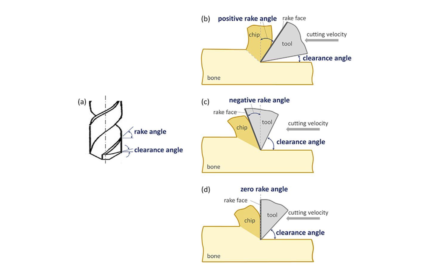 Parameters Affecting Mechanical and Thermal Responses in Bone Drilling ...